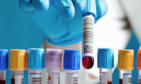 Timed testing's role in collecting medically useful samples | Aculabs Inc