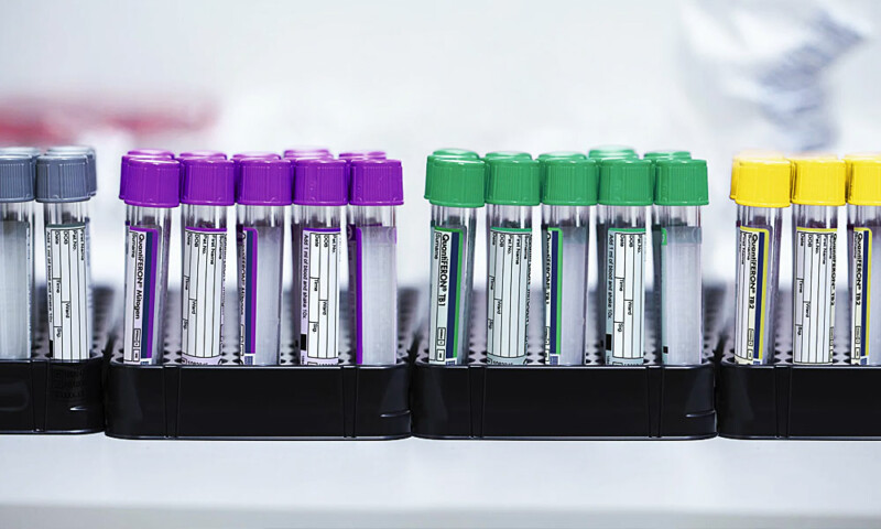 Letter from the Director: QuantiFERON-TB Gold Plus testing offers ...